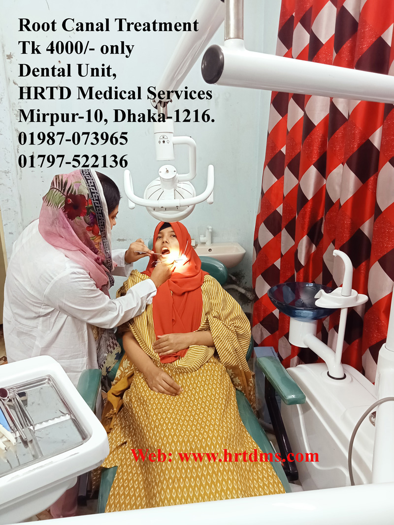 Best Root Canal Treatment in Mirpur. Mobile No. 01987-073965